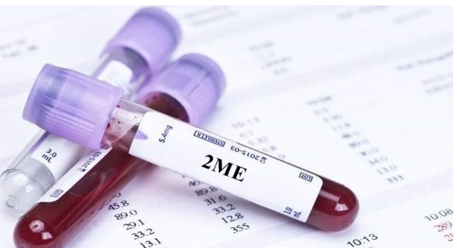 آزمایش 2ME (2-مرکاپتواتانول) در تشخیص بروسلوز | مجله نیاز طب